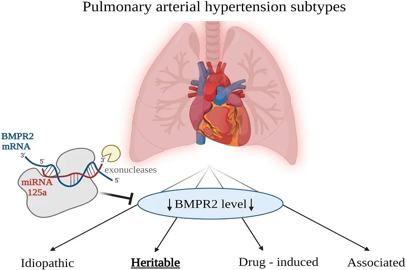 Pulmonary Arterial Hypertension (PAH) Treatment Methods